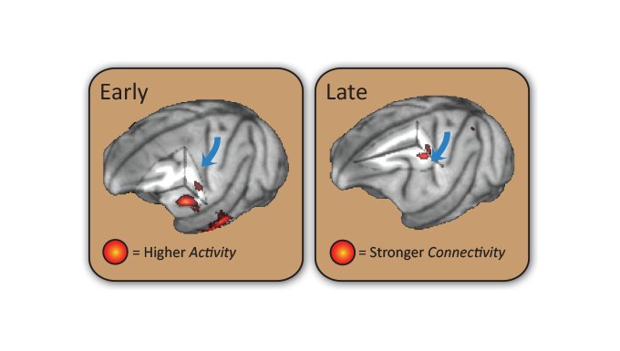 The Two Stages Of Brain Recovery - Asian Scientist Magazine