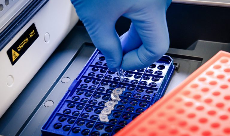 Three Ways AI Will Supercharge Lab Diagnostics – Asian Scientist Magazine