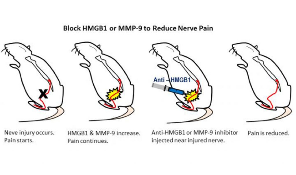 Reducing Nerve Pain With Less Risk Of Addiction – Asian Scientist Magazine